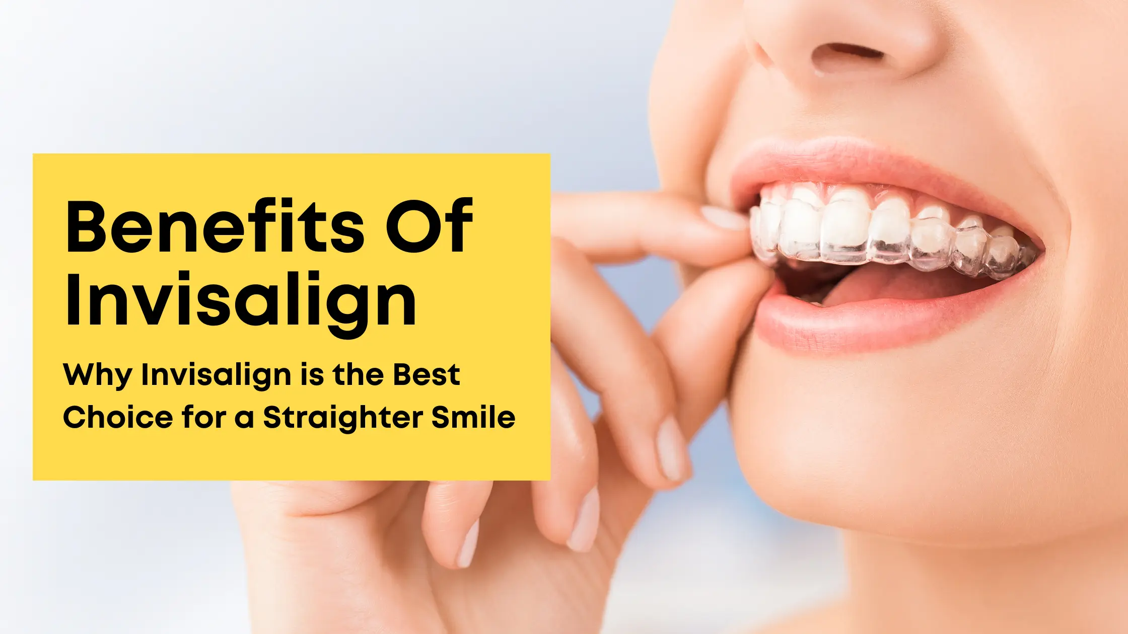 Benefits Of Invisalign - Why it is the best choice to get a perfect smile?